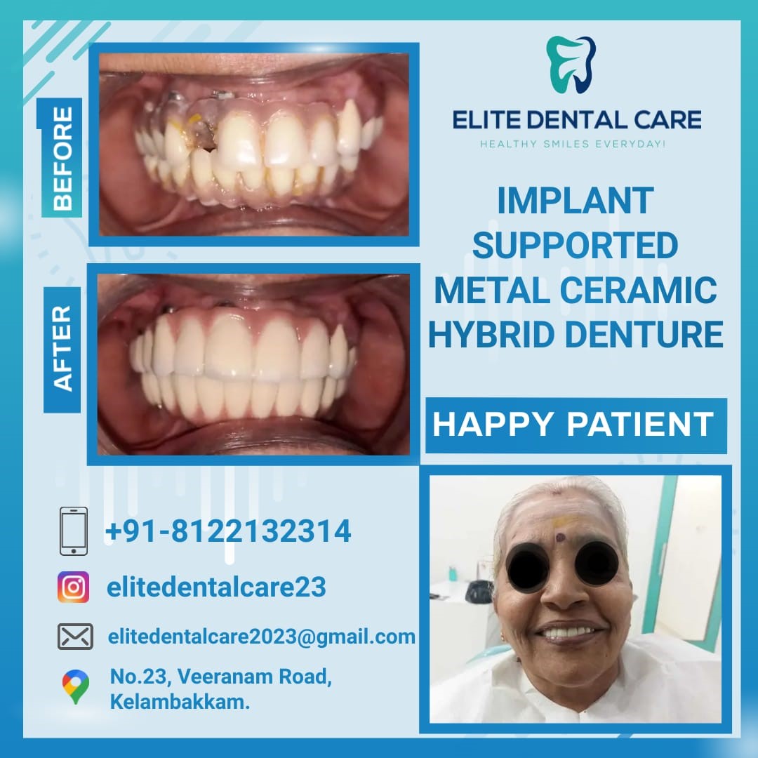 Elite Dental Care